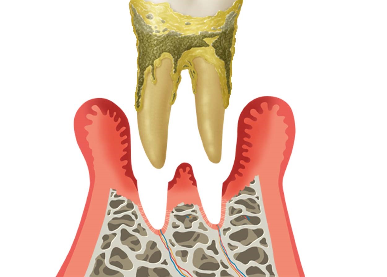 一般歯科 - 京都市伏見区桃山町の歯科・歯医者《ビオラ歯科医院》 | 夜間・休日診療やインプラント